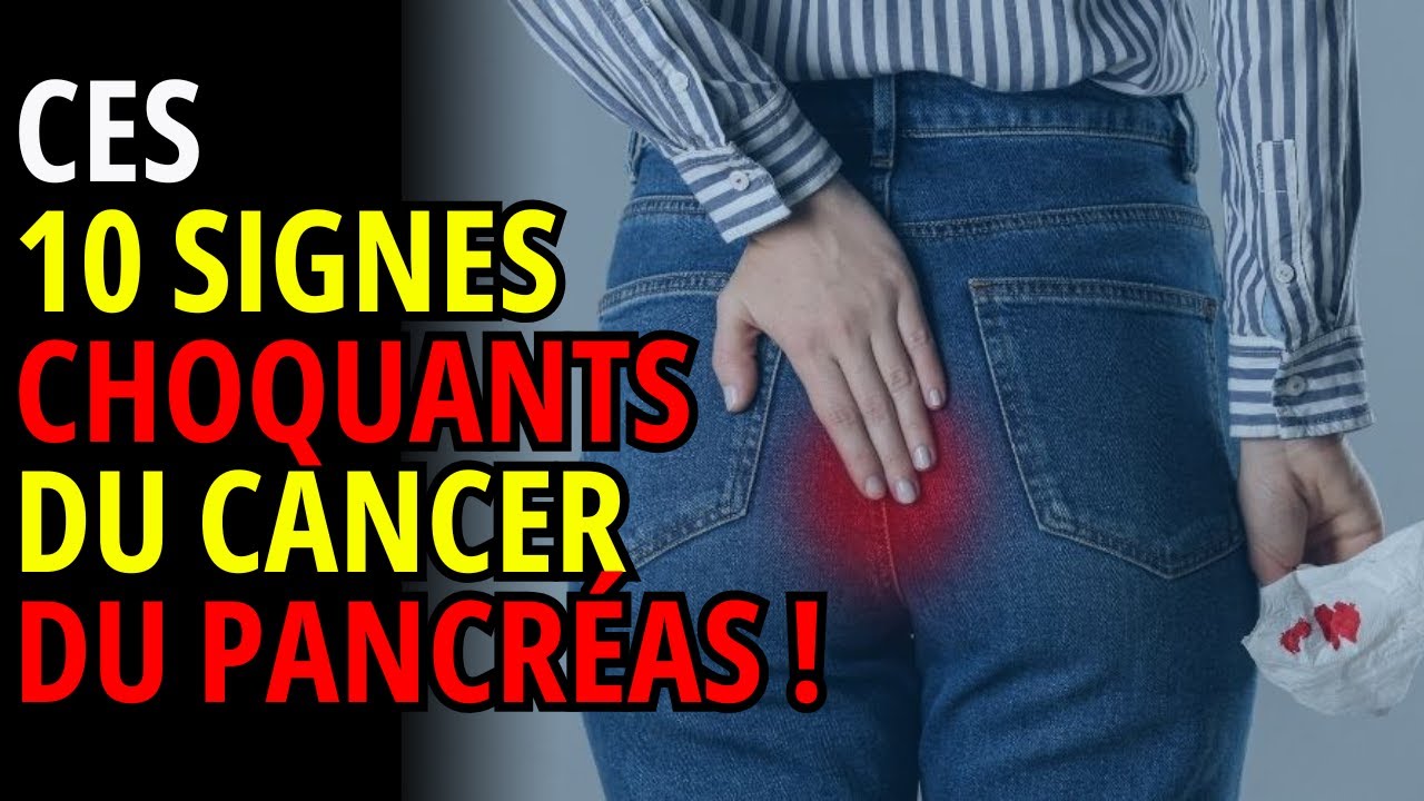 10 symptômes du cancer du pancréas qui vont vous choquer - YouTube