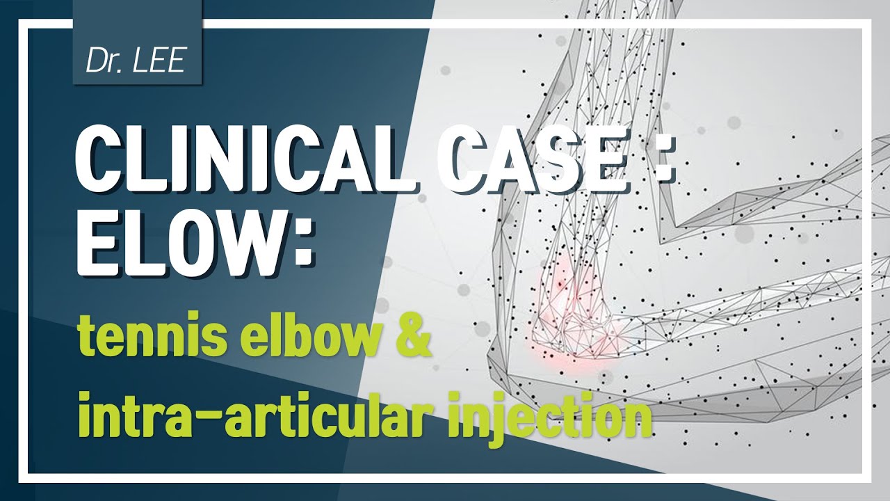 Clinical case: elbow: tennis elbow & intra-articular injection;US;basic ...