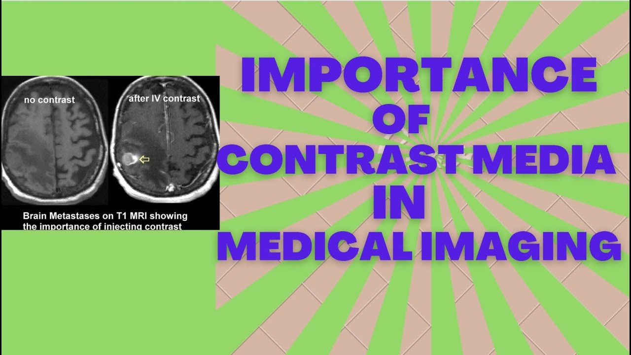 Importance of contrast media in Medical imaging | Radiotherapy edutech ...