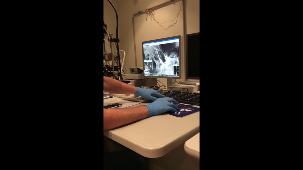 SEM OPERATION 04 - YouTube