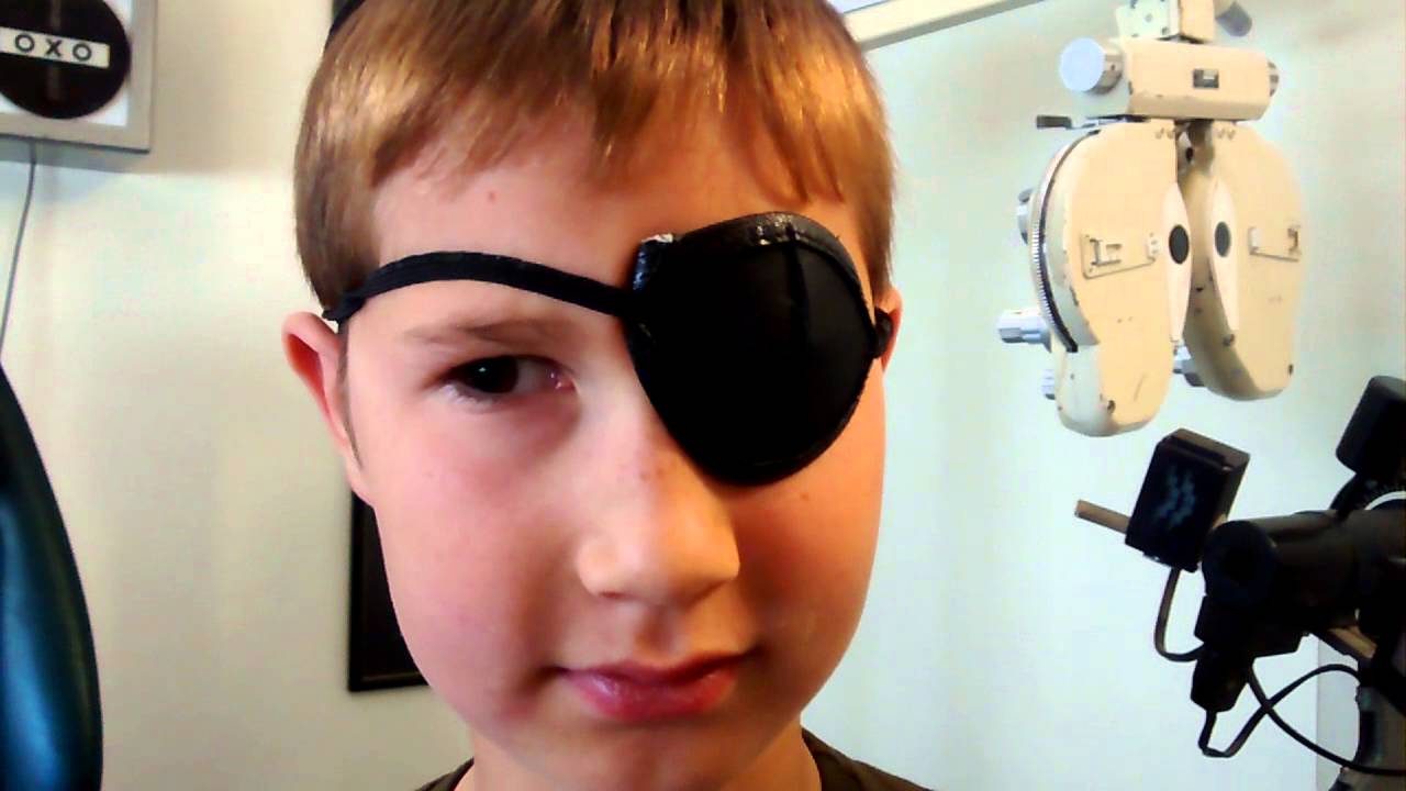 Extremely Reduced Eye Movement Ability in child with Nystagmus - YouTube