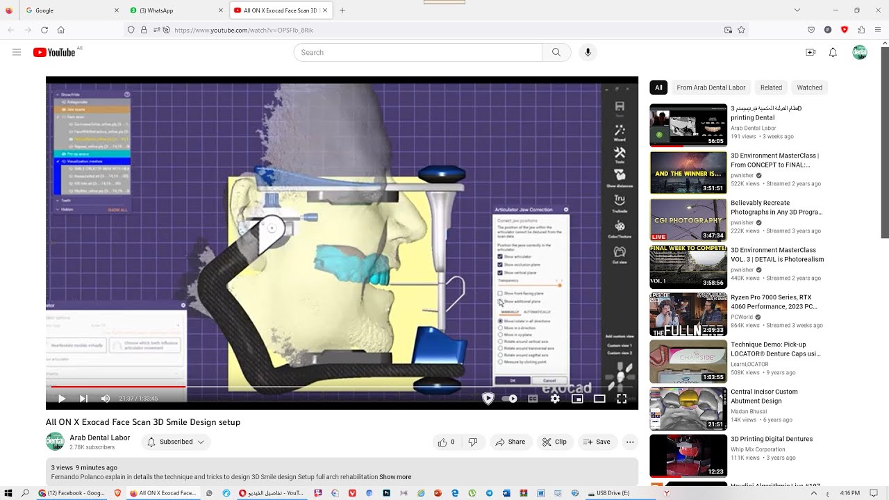 All ON X Exocad Face Scan 3D Smile Design setup - YouTube