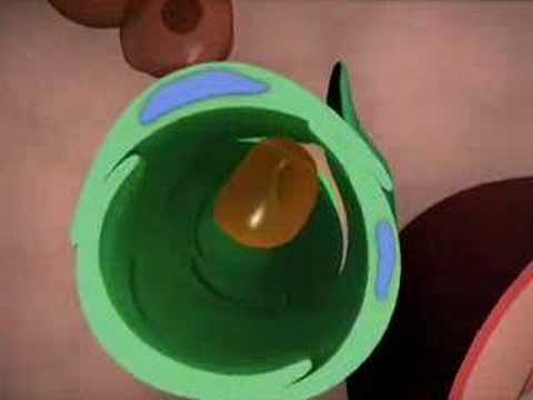 How Quickly Does Skin Cancer Progress
