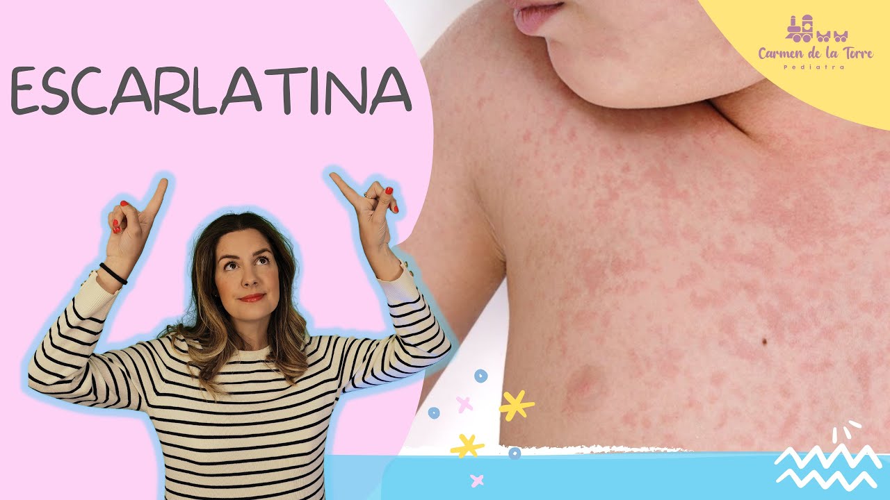 ¡MI PEQUE TIENE ESCARLATINA! - YouTube
