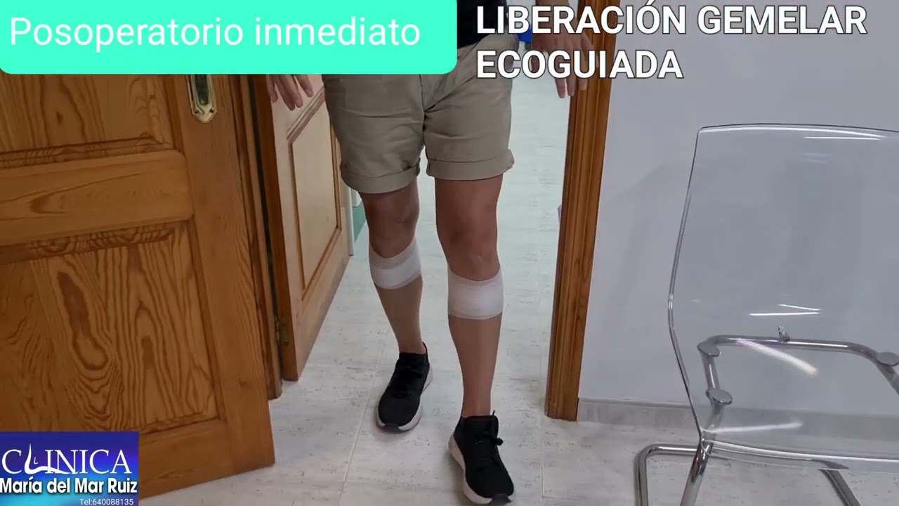 Postoperatorio de cirugía de acortamiento - alargamiento de gemelos ...