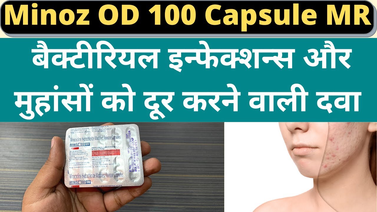 Minoz OD 100 Capsule Uses, Benefits & Side effects | To Treat Bacterial ...