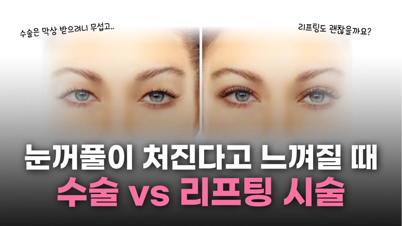 처진 눈꺼풀 수술 Vs 리프팅 중 어떤 선택을 해야할까 Youtube