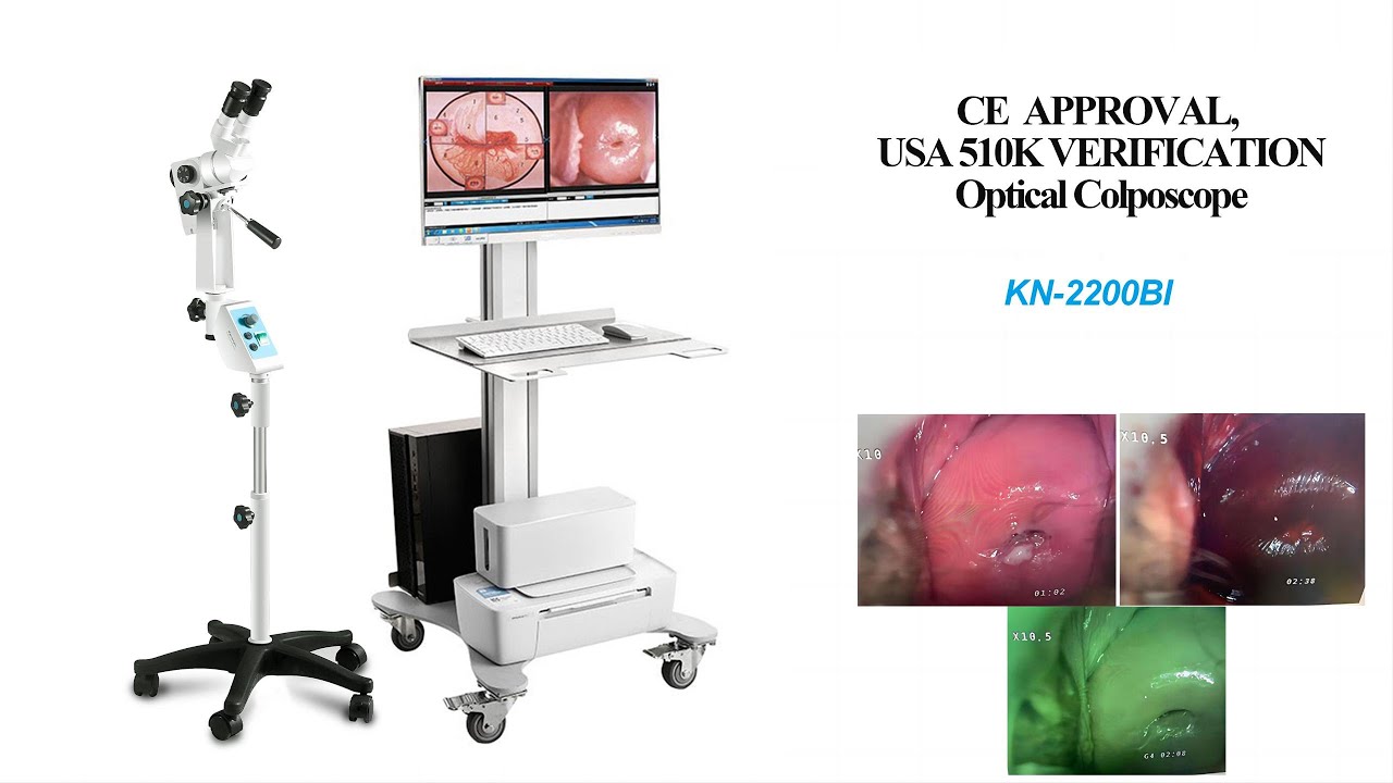 Kernelmed Gynecology Colposcopy Medical Optic Instrument Colposcope KN ...