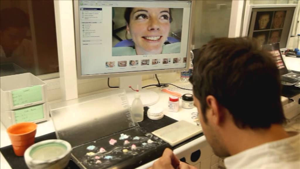 Clear Aligner Pro-Orto-Dent - YouTube