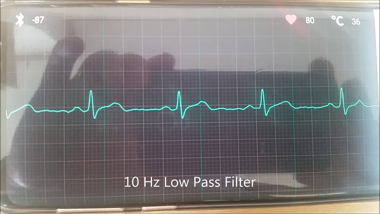 ECG waveform of LPF 10Hz 30Hz 80Hz actual person-Updated - YouTube