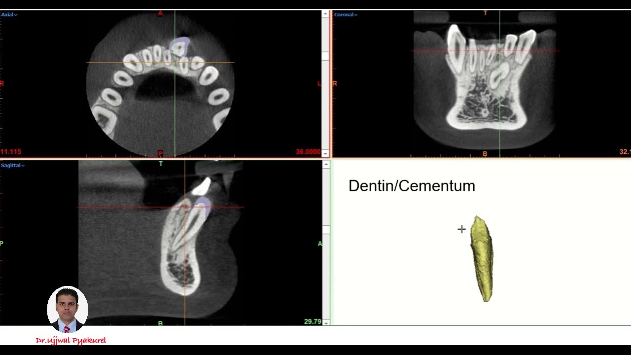 CBCT Workflow - YouTube