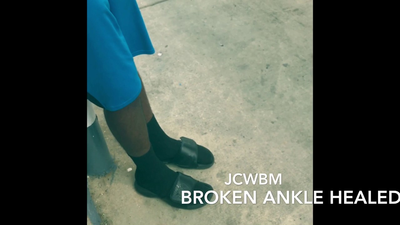 BROKEN ANKLE HEALED BY JESUS CHRIST - YouTube