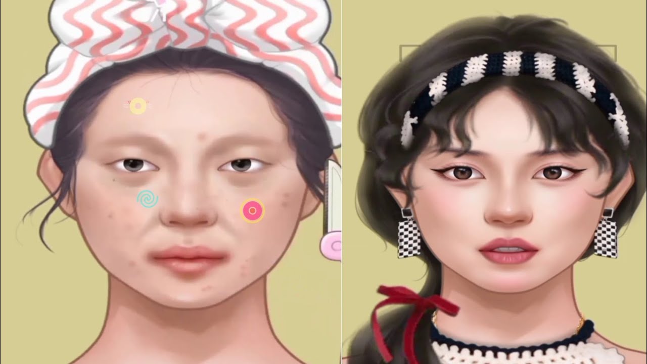 Asmr Black Head Removal Treatment Animation For Girl | Pimple popping ...