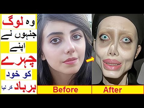 People Who Destroyed their Faces with Cosmetic Surgeries - YouTube
