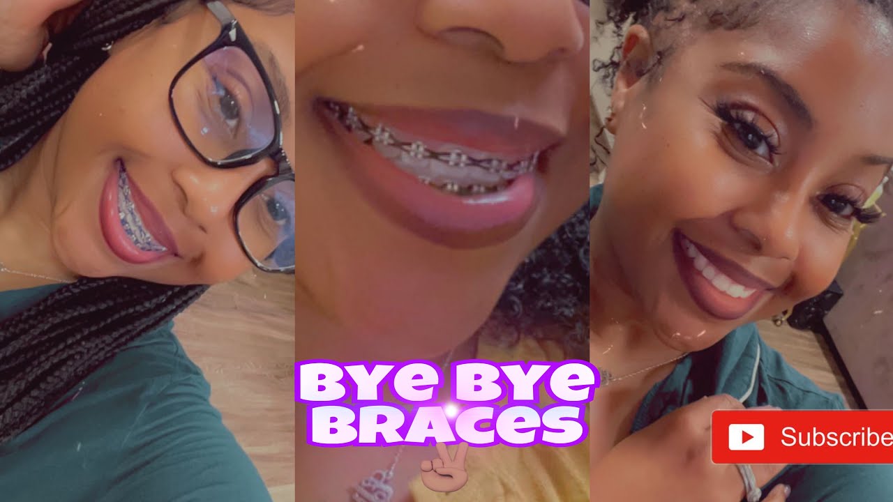 BYE BYE BRACES!! The Braces are GONE!! - YouTube