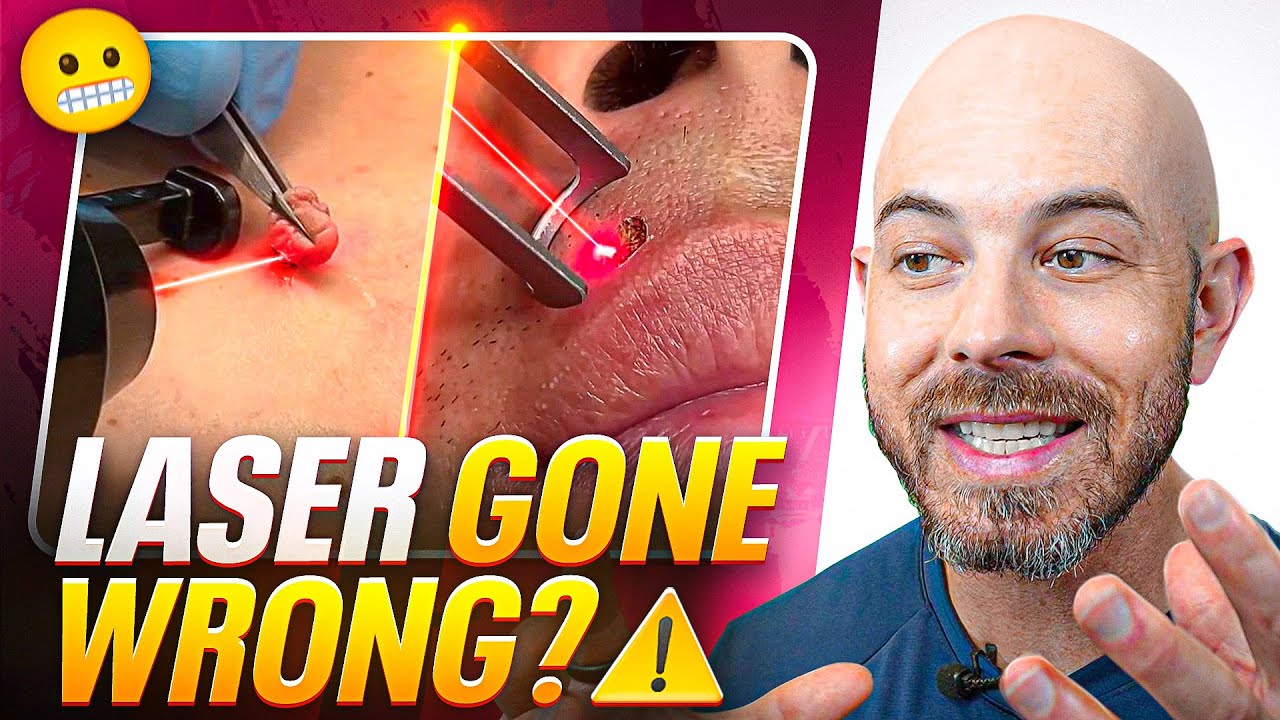 Laser Fails & Skin Treatment Dangers: Dermatologist Reacts - YouTube