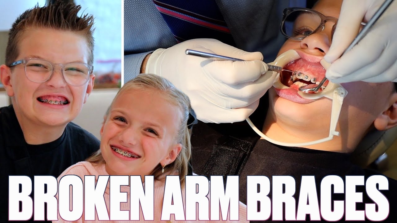 GETTING BRACES PUT ON FOR THE FIRST TIME WITH A BROKEN ARM | THIS IS A ...