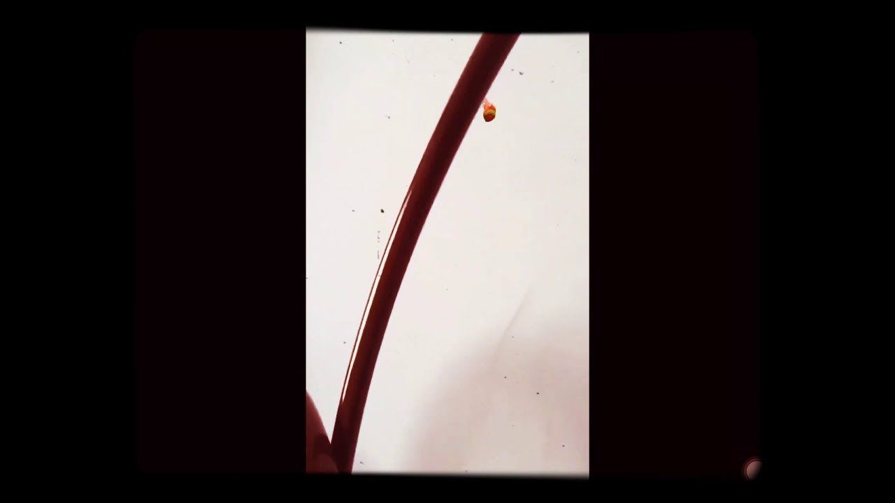 floating patrick - YouTube