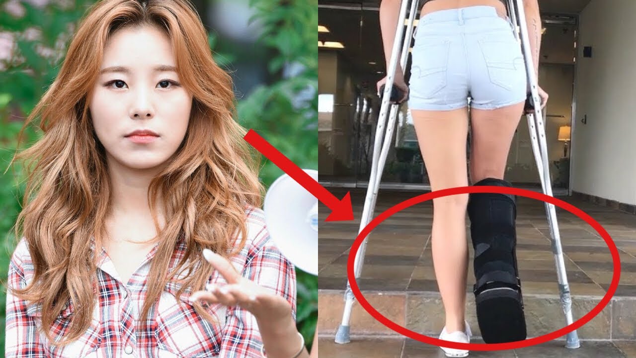 MAMAMOO Wheein Twists Her Ankle But Still Goes To Vietnam To See Fans ...