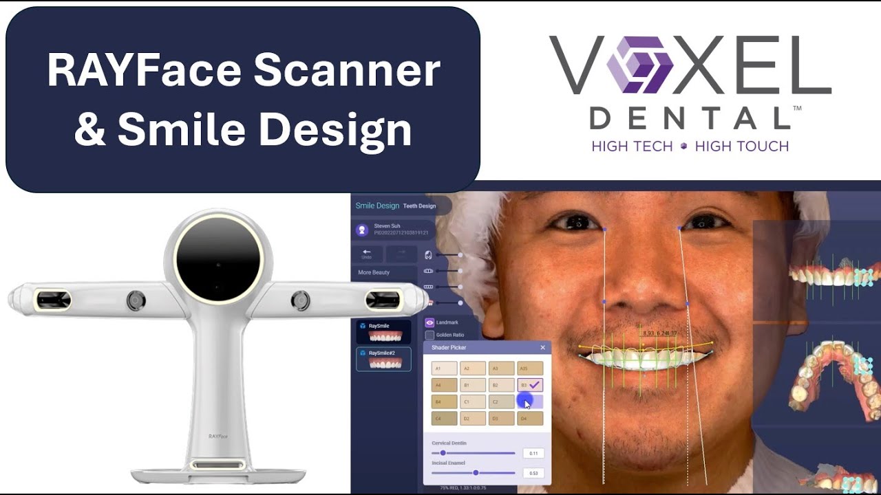 RAYFace Scanner & Smile Design - YouTube