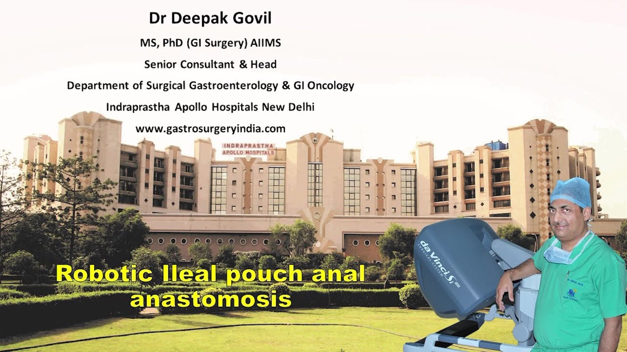 Robotic Ileal Pouch Anal Anastomosis (IPAA) by Dr Deepak Govil, GI ...