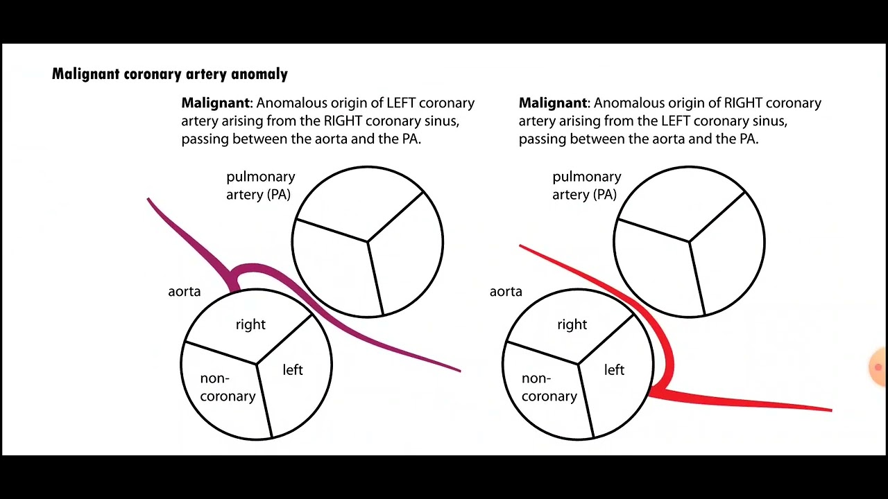 CARDIOVASCULAR IMAGING CORE RADIOLOGY PDF TO VIDEO - YouTube