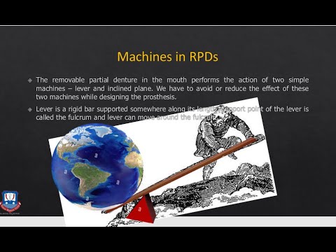 BIOMECHANICAL CONSIDERATIONS IN RPD DESIGN AND SUPPORT FOR THE DISTAL ...
