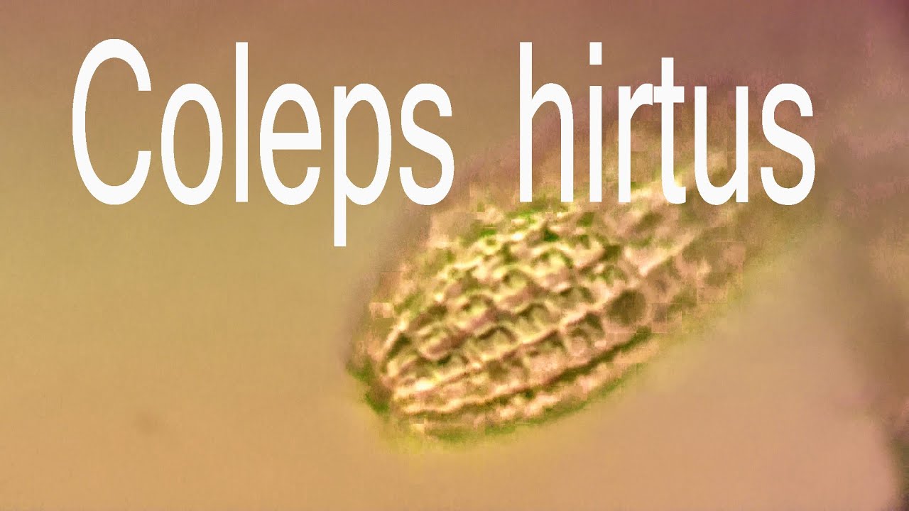 coleps hirtus - YouTube