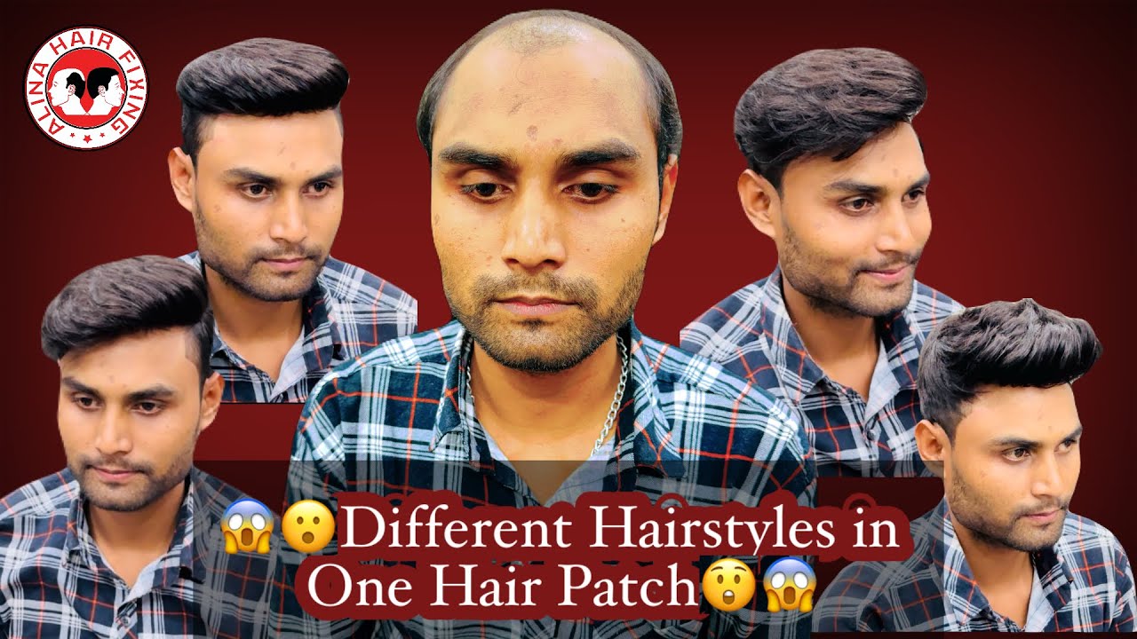 Hair fixing for men in bangalore Non surgical hair replacement for men ...