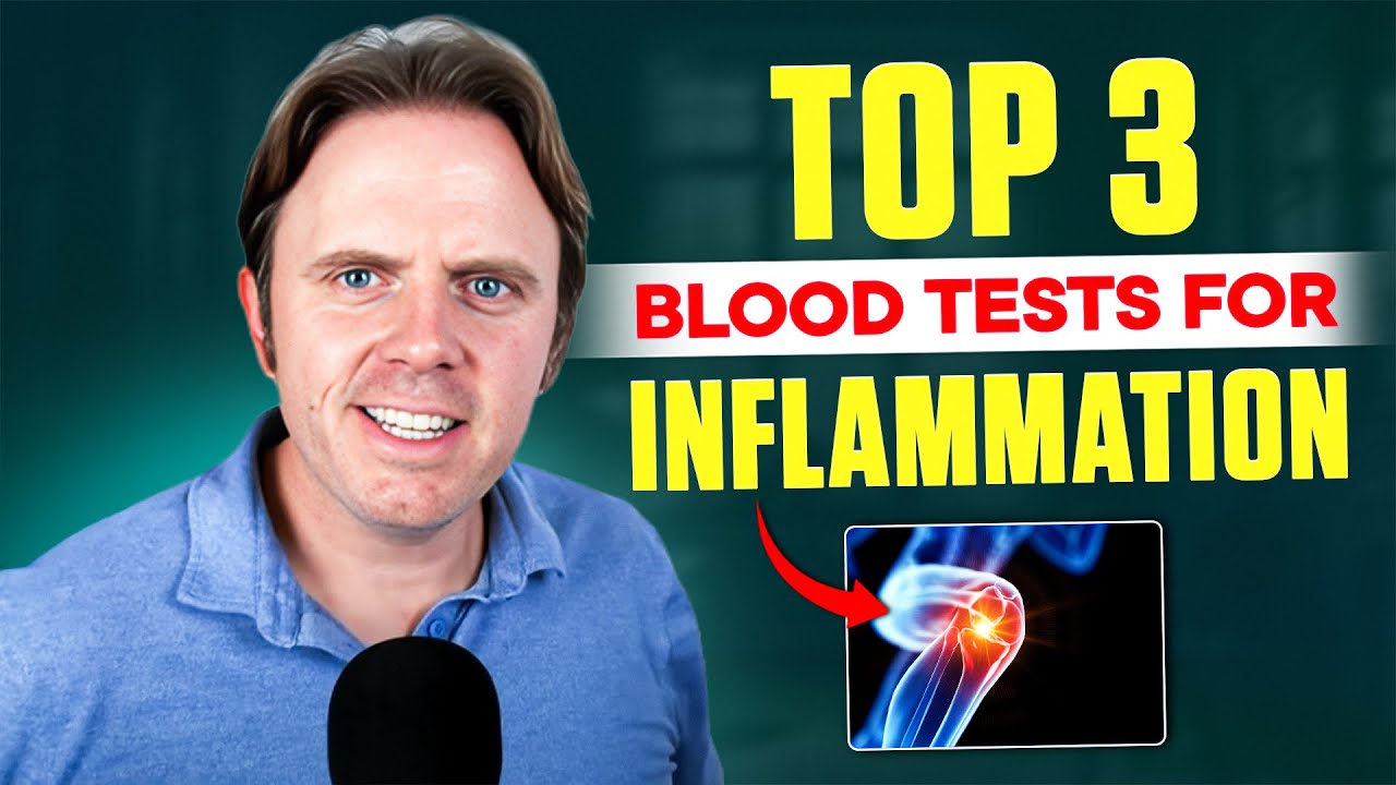 Top 3 Lab Tests You Need to Know to Identify Inflammation in Your Body ...