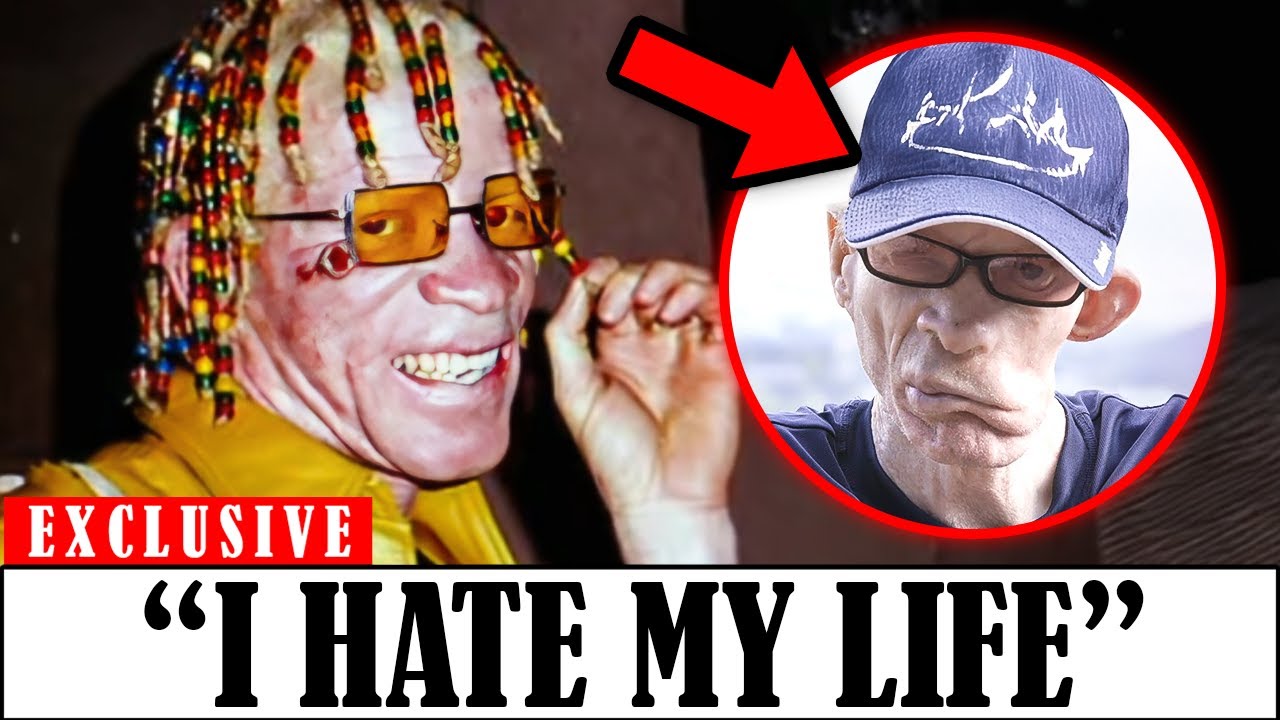 The Heartbreaking Tragedy Of Yellowman The Original King Of Dancehall ...