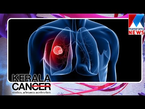 Dr. K. Pavithran, speaks about lung cancer and treatments | Manorama ...