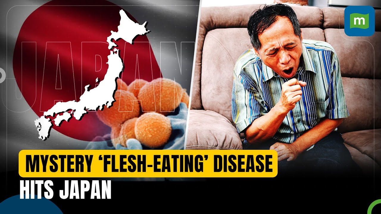 Japan’s Mystery Flesh-Eating Disease: Is It The Return Of Covid Like ...