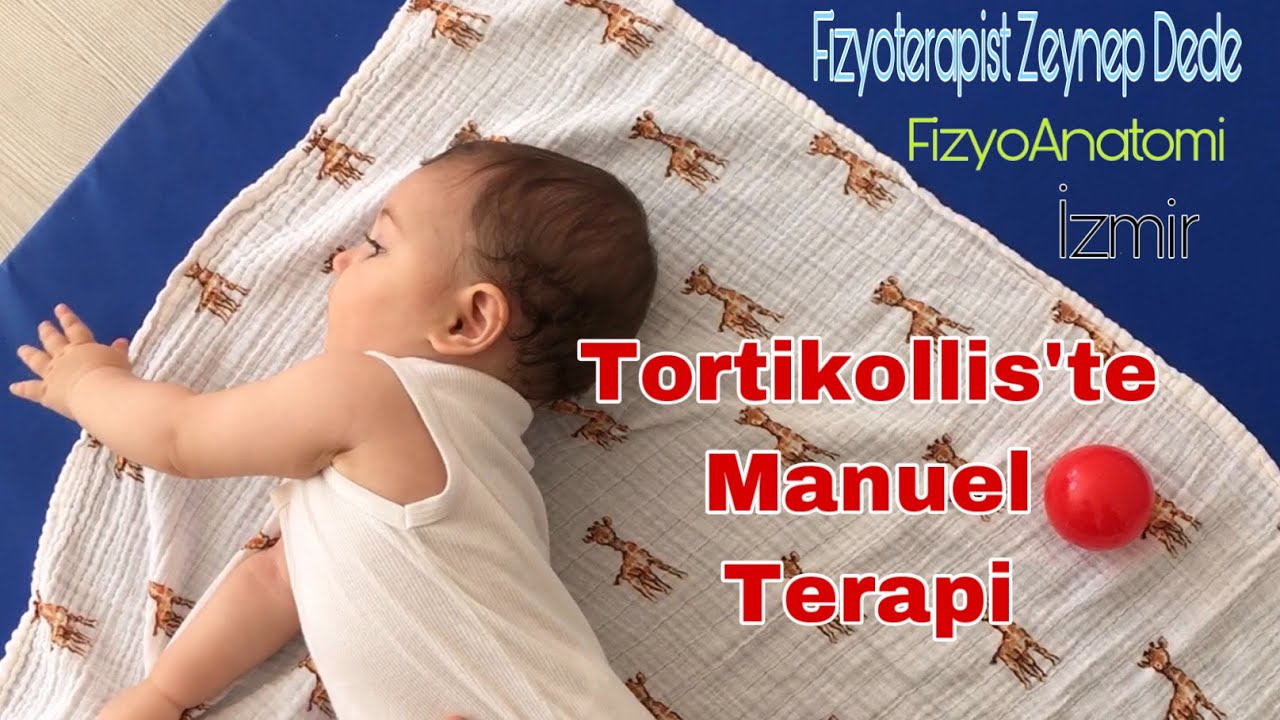 Tortikollis Öncesi/Sonrası 🚀🚀 - YouTube