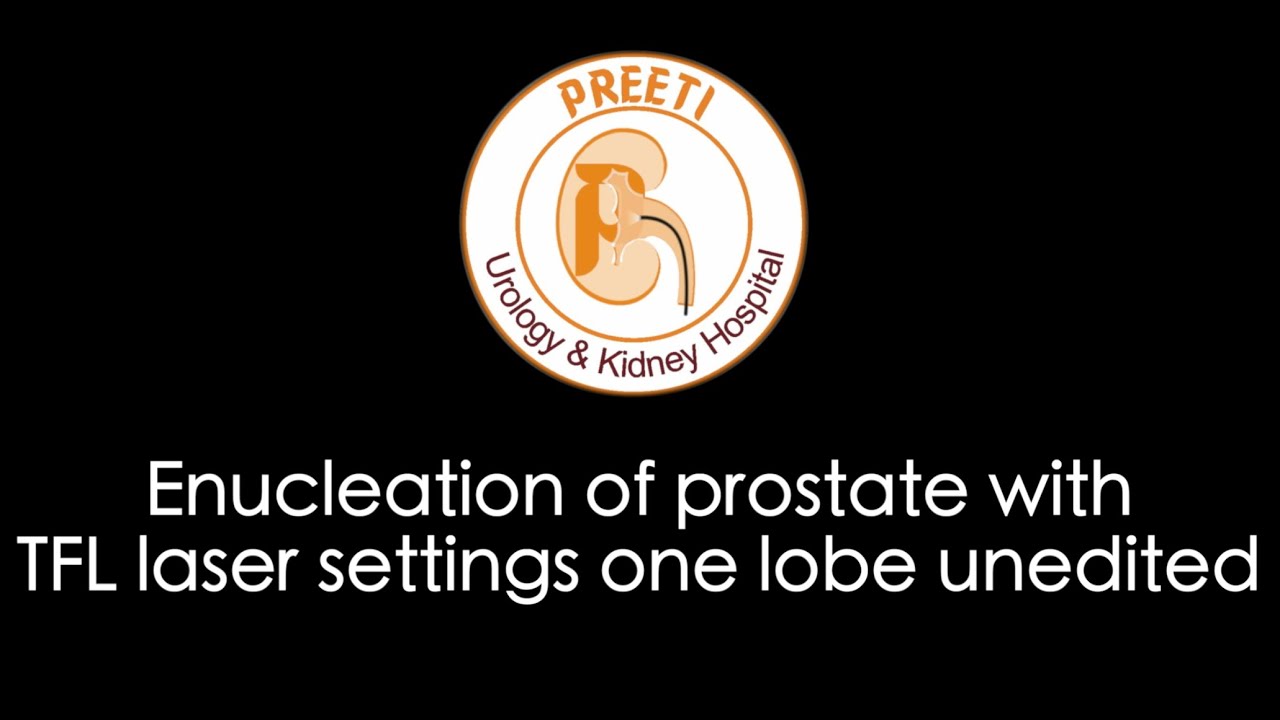 Enucleation of Prostate with TFL laser settings one lobe - unedited ...