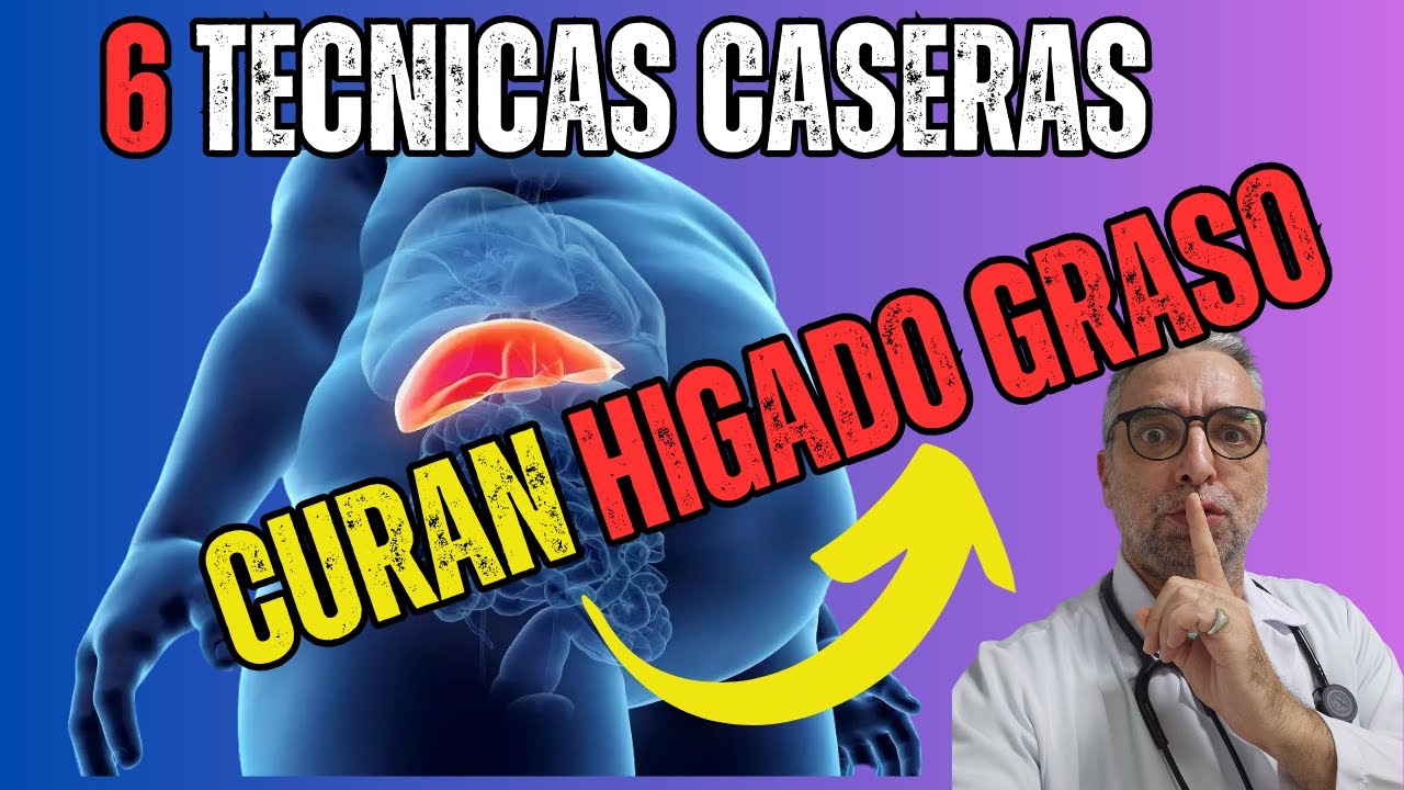 HIGADO GRASO. Sintomas, etiologia, fisiopatologia y 6 técnicas caseras ...