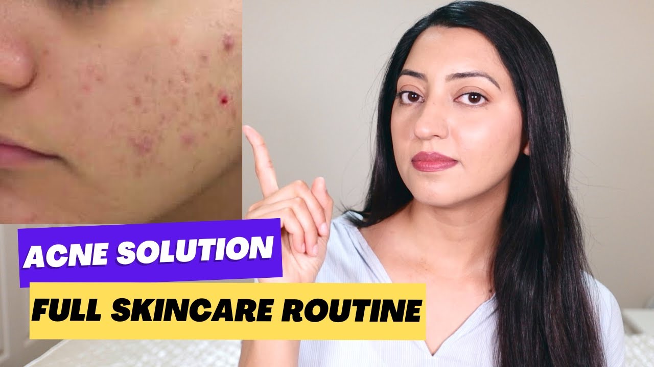 Complete Skincare Routine for Acne - YouTube