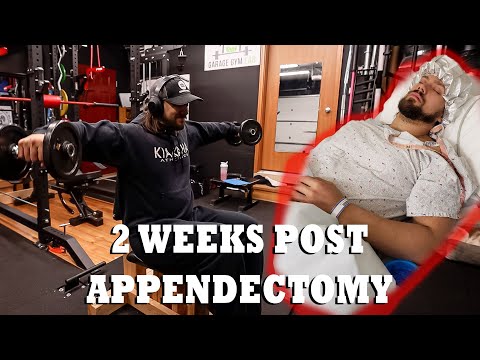 When Can I Exercise After Laparoscopic Appendectomy