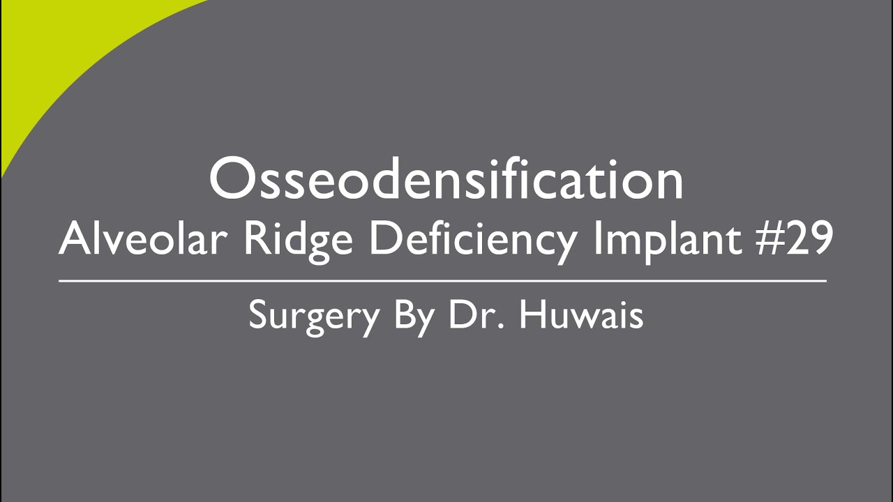 Osseodensification Alveolar Ridge Deficiency Implant #29 Surgery By Dr ...