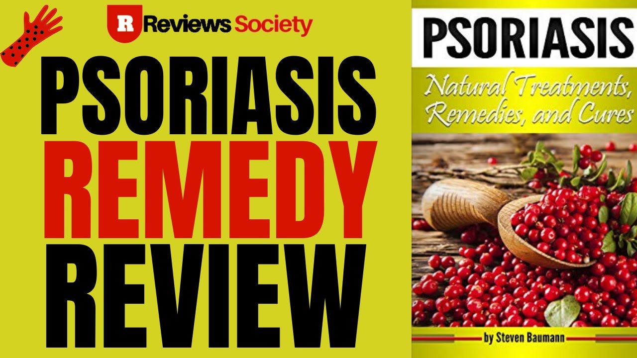 Natural Treatments And Home Remedies For Psoriasis Relief Must Watch Youtube