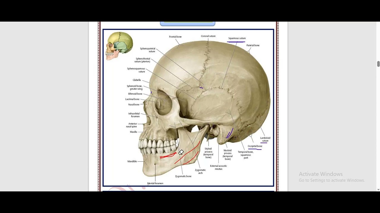 Practical Skull 3 ( Norma Lateralis )_Dr.Ahmed Hassan Elbatahgy - YouTube