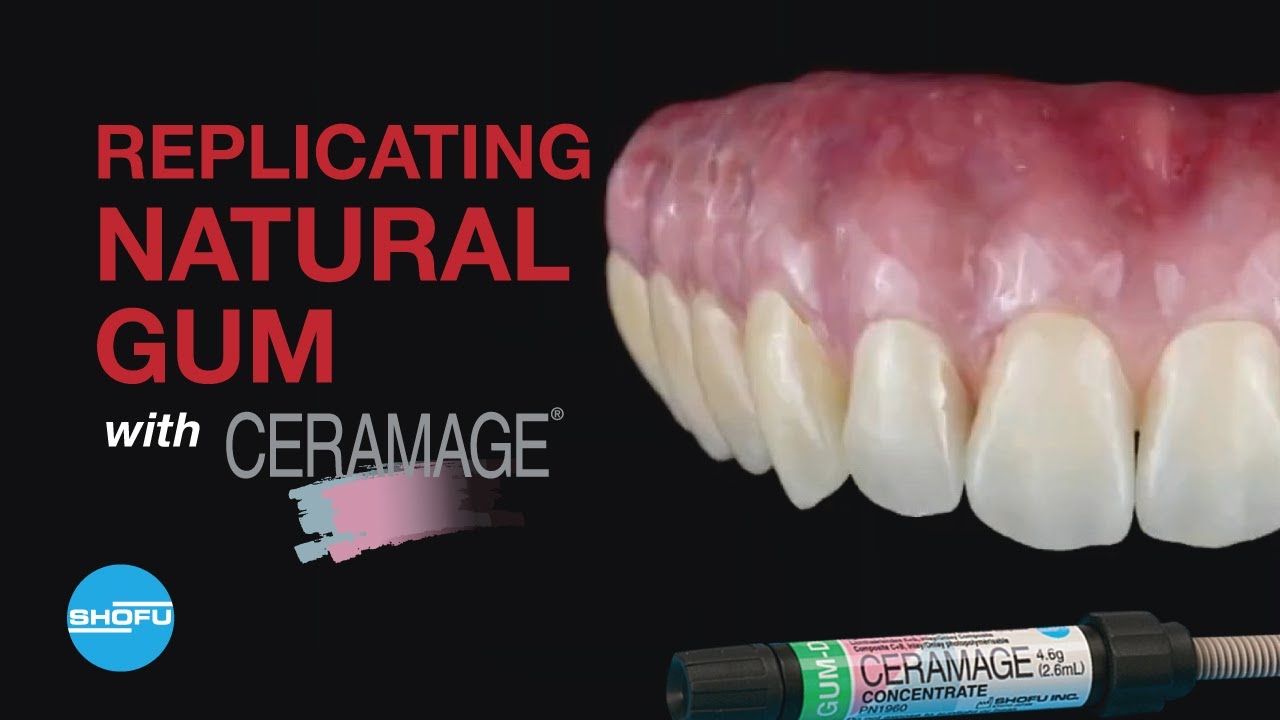 Replicating the natural gum with Ceramage - YouTube