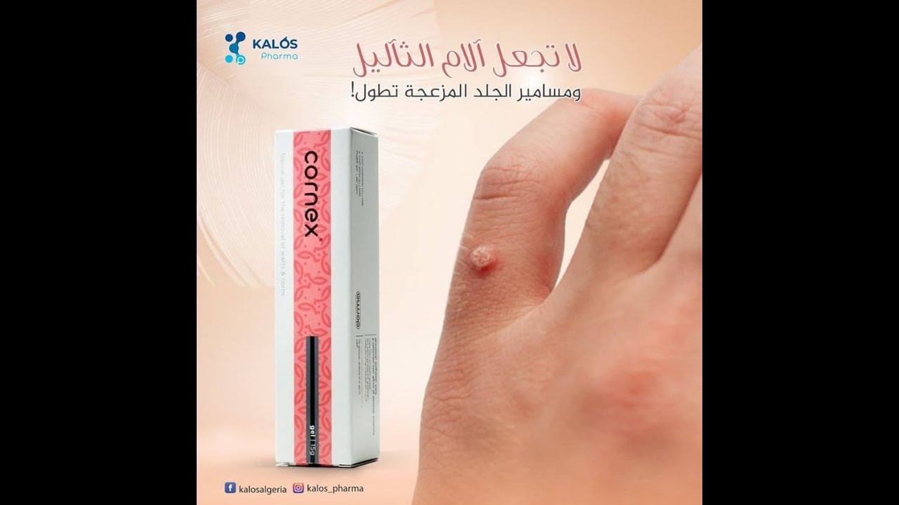 Cornex 05 Yt 1 - YouTube