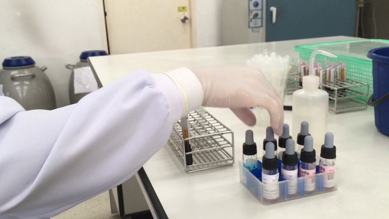 ABO grouping by standard tube technique - YouTube