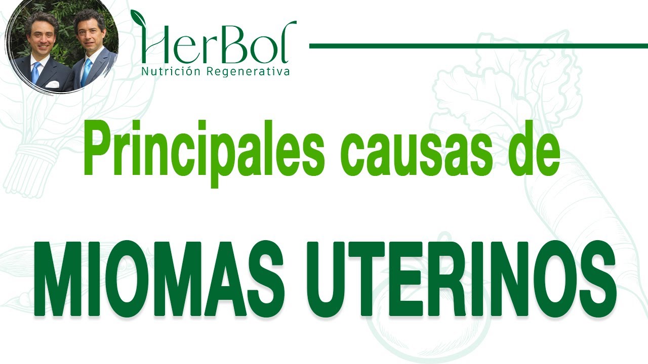 Las 4 principales causas de miomas uterinos y que hacer para ...