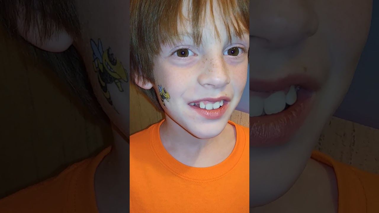 Loose tooth (hanging by a thread) lol - YouTube
