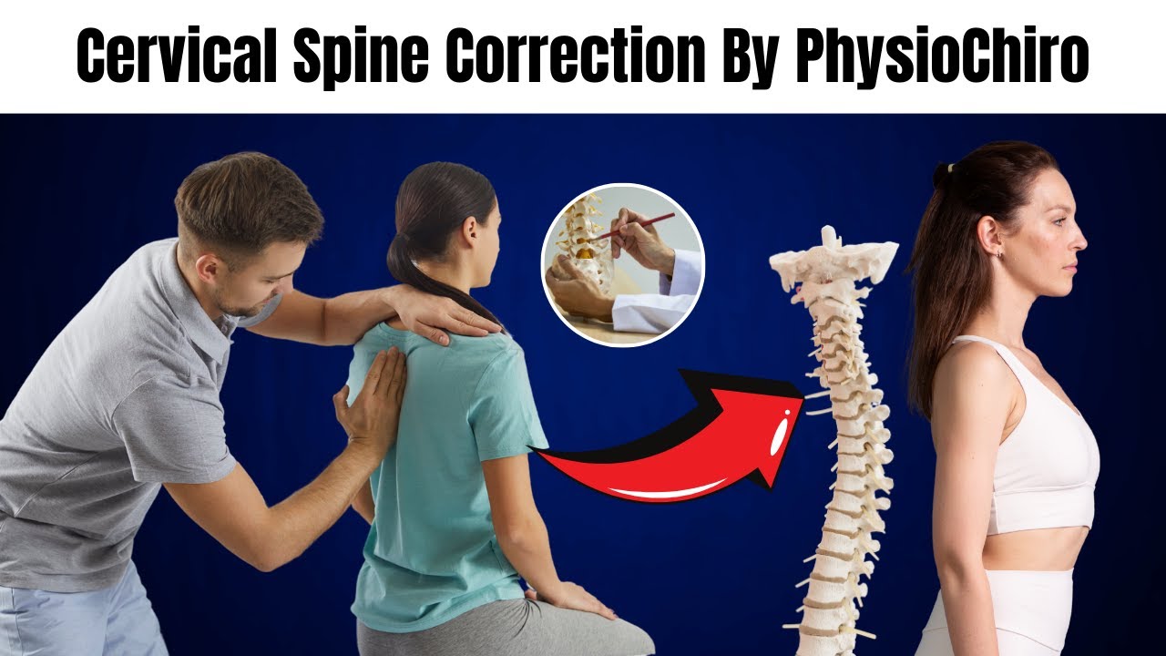 Cervical Spine Correction: Restore Posture & Relieve Pain | PhysioChiro ...