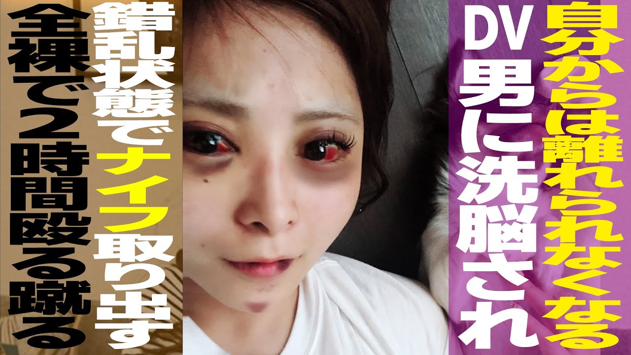 過去受けた元カレからのdv被害について。 Youtube