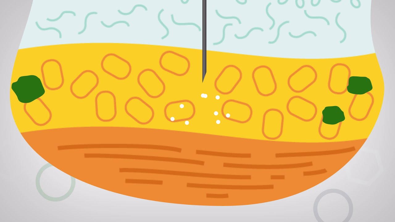 SubCutaneous Injection Site SimulatOR (SCISSOR) from Pion Inc ...