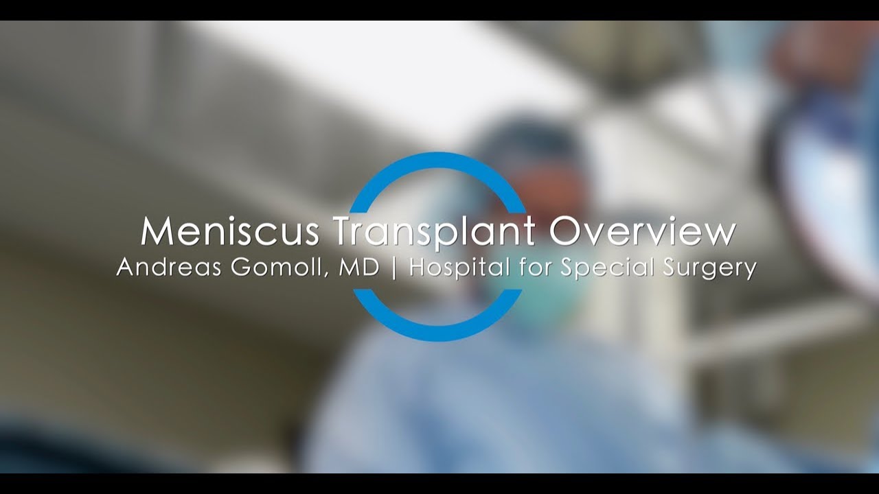 Meniscus Transplant Overview - YouTube